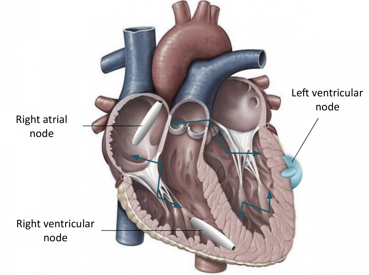 pacemaker cardiaci MicroPort - Sanità Digitale